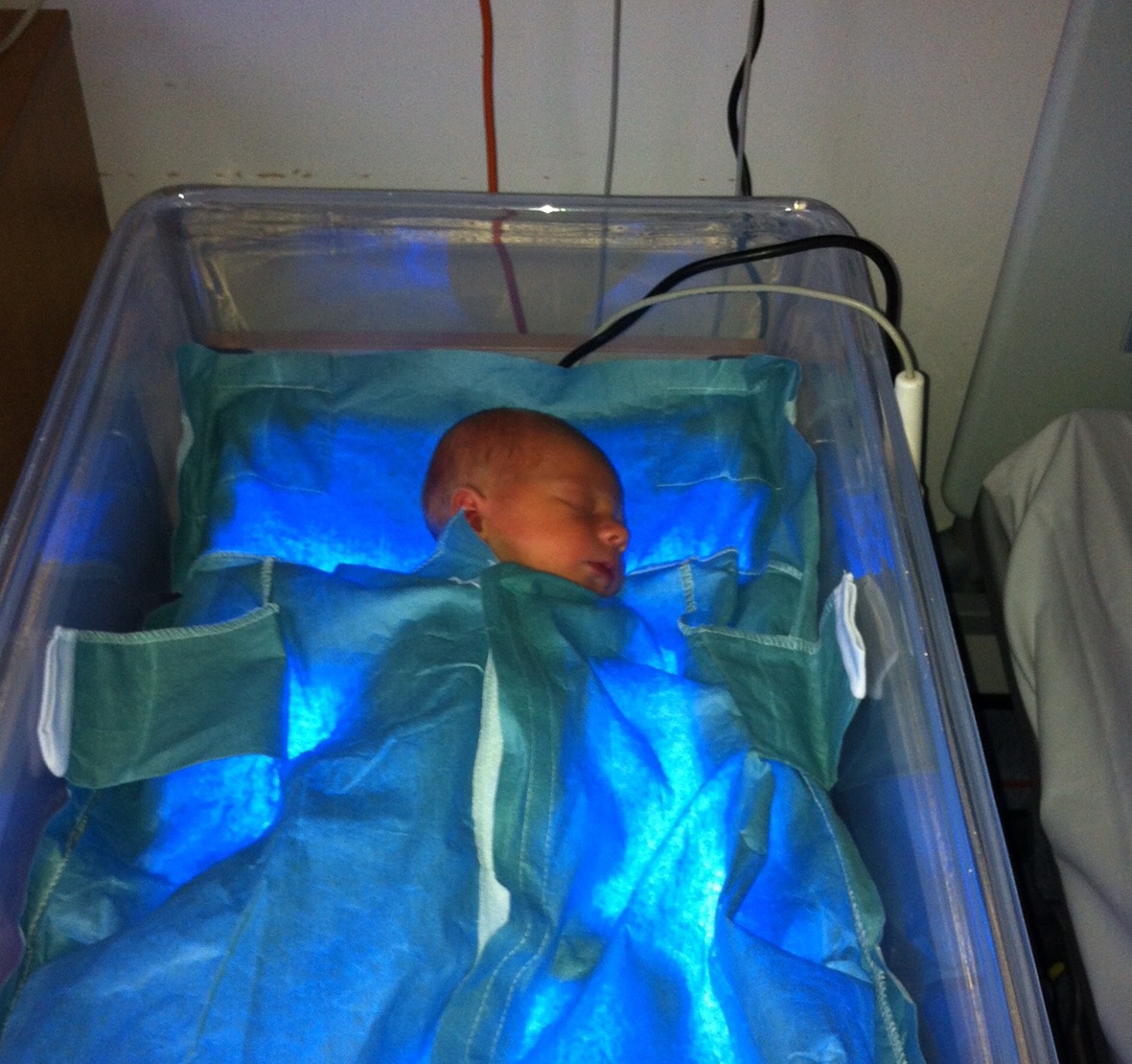 Dehydration & Jaundice | The GP Infant Feeding Network (UK)